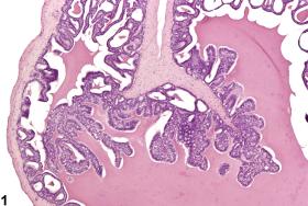 Seminal Vesicle, Epithelium - Hyperplasia - Nonneoplastic Lesion Atlas