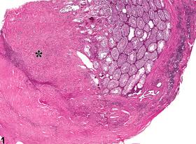 Testis - Fibrosis - Nonneoplastic Lesion Atlas