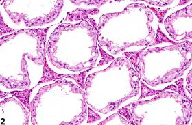 Testis, Germinal Epithelium - Atrophy - Nonneoplastic Lesion Atlas