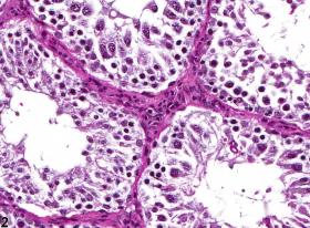 Testis, Germinal Epithelium - Degeneration - Nonneoplastic Lesion Atlas