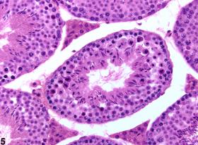 Testis, Germinal Epithelium - Degeneration - Nonneoplastic Lesion Atlas