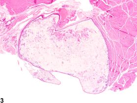 Skeletal muscle - Cyst - Nonneoplastic Lesion Atlas