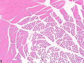 Skeletal muscle - Edema - Nonneoplastic Lesion Atlas