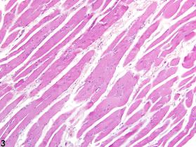 Skeletal muscle - Edema - Nonneoplastic Lesion Atlas