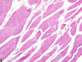 Skeletal muscle - Edema - Nonneoplastic Lesion Atlas