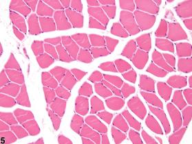 Skeletal muscle - Edema - Nonneoplastic Lesion Atlas