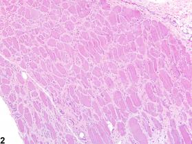 Skeletal muscle - Fibrosis - Nonneoplastic Lesion Atlas