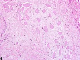 Skeletal muscle - Fibrosis - Nonneoplastic Lesion Atlas