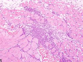 Skeletal muscle - Inflammation - Nonneoplastic Lesion Atlas