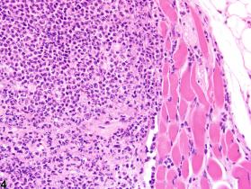 Skeletal muscle - Inflammation - Nonneoplastic Lesion Atlas