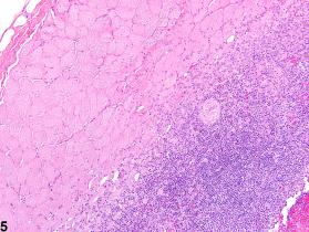 Skeletal muscle - Inflammation - Nonneoplastic Lesion Atlas