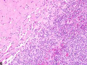 Skeletal muscle - Inflammation - Nonneoplastic Lesion Atlas