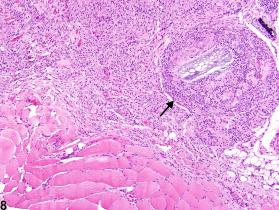 Skeletal muscle - Inflammation - Nonneoplastic Lesion Atlas