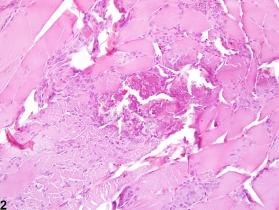 skeletal muscle - Necrosis - Nonneoplastic Lesion Atlas