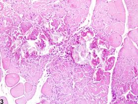 Skeletal muscle - Necrosis - Nonneoplastic Lesion Atlas