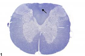 Nerve - Axonopathy - Nonneoplastic Lesion Atlas