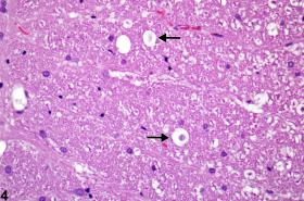 Nerve - Axonopathy - Nonneoplastic Lesion Atlas