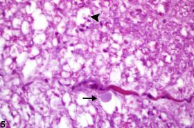 Nerve - Axonopathy - Nonneoplastic Lesion Atlas