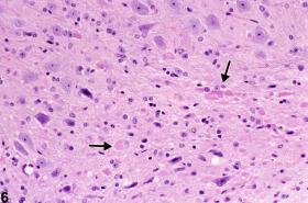 Nerve - Axonopathy - Nonneoplastic Lesion Atlas