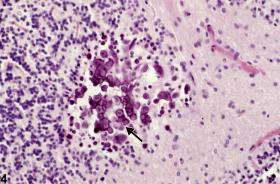Brain - Mineralization - Nonneoplastic Lesion Atlas