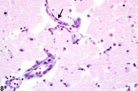 Brain - Necrosis - Nonneoplastic Lesion Atlas