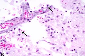 Brain - Necrosis - Nonneoplastic Lesion Atlas