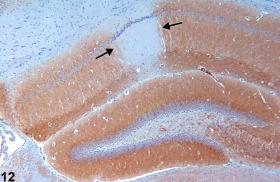 Brain - Necrosis - Nonneoplastic Lesion Atlas
