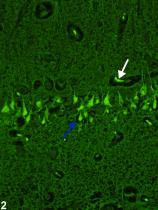 Brain, Neuron - Necrosis - Nonneoplastic Lesion Atlas
