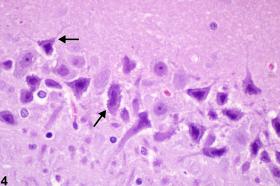 Brain, Neuron - Necrosis - Nonneoplastic Lesion Atlas