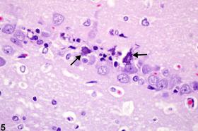 Brain, Neuron - Necrosis - Nonneoplastic Lesion Atlas