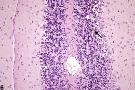 Brain, Neuron - Necrosis - Nonneoplastic Lesion Atlas
