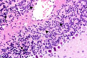 Brain, Neuron - Necrosis - Nonneoplastic Lesion Atlas