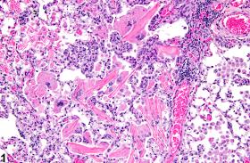 Lung - Crystals - Nonneoplastic Lesion Atlas