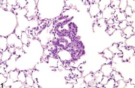 Lung, Epithelium, Alveolus - Hyperplasia - Nonneoplastic Lesion Atlas