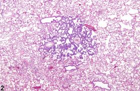 Lung, Epithelium, Alveolus - Hyperplasia - Nonneoplastic Lesion Atlas
