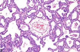 Lung, Epithelium, Alveolus - Hyperplasia - Nonneoplastic Lesion Atlas