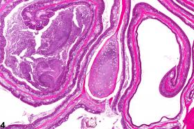 Nose - Inflammation - Nonneoplastic Lesion Atlas