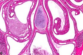 Nose - Inflammation - Nonneoplastic Lesion Atlas