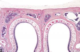 Nose, Olfactory Epithelium - Atrophy - Nonneoplastic Lesion Atlas