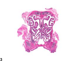 Nose, Turbinate - Atrophy - Nonneoplastic Lesion Atlas