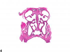 Nose, Turbinate - Atrophy - Nonneoplastic Lesion Atlas