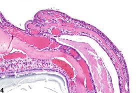 Nose, Turbinate - Synechia - Nonneoplastic Lesion Atlas