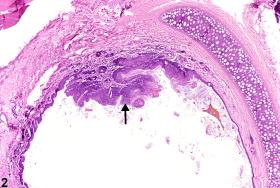 Ear, Epithelium - Hyperplasia - Nonneoplastic Lesion Atlas