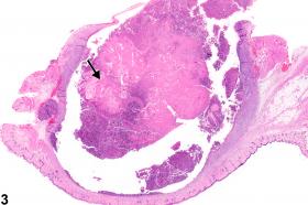 Ear - Inflammation - Nonneoplastic Lesion Atlas