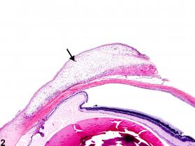 Eye, Conjunctiva - Edema - Nonneoplastic Lesion Atlas