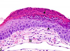 Eye - Inflammation - Nonneoplastic Lesion Atlas