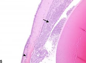 Eye - Inflammation - Nonneoplastic Lesion Atlas