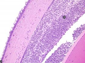 Eye - Inflammation - Nonneoplastic Lesion Atlas