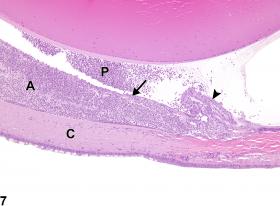Eye - Inflammation - Nonneoplastic Lesion Atlas