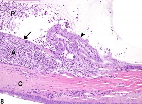 Eye - Inflammation - Nonneoplastic Lesion Atlas